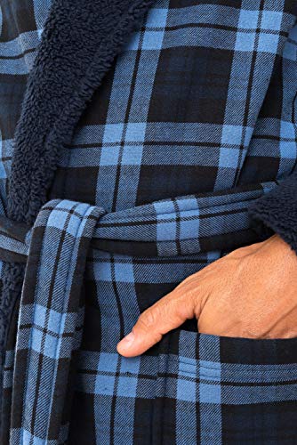 Cuáles son los diferentes tipos de vellón? - Entretenimiento Digital